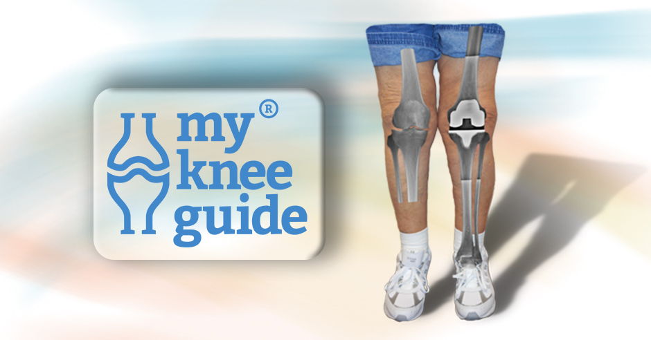 Knee Replacement Surgery, Learn, Organize and Find - My Knee Guide