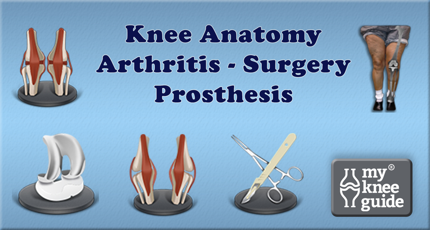 The Knee - Learning Center